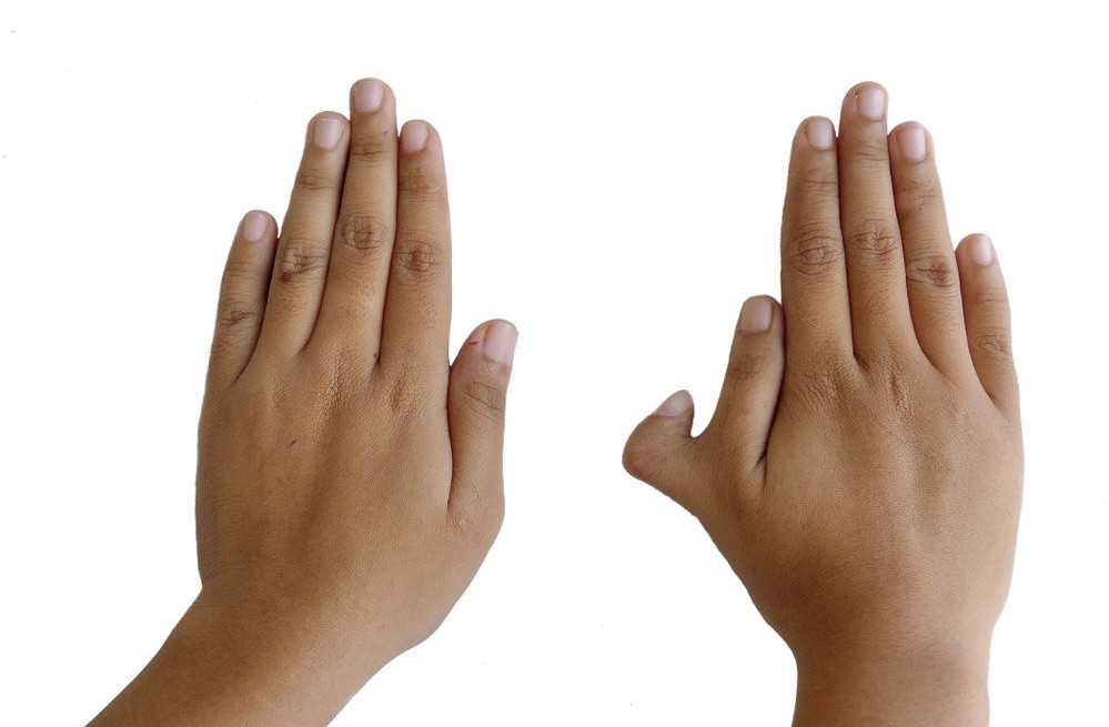 Can Having Six Fingers Be a Sign of Special Luck or Destiny? - Rise&Inspire